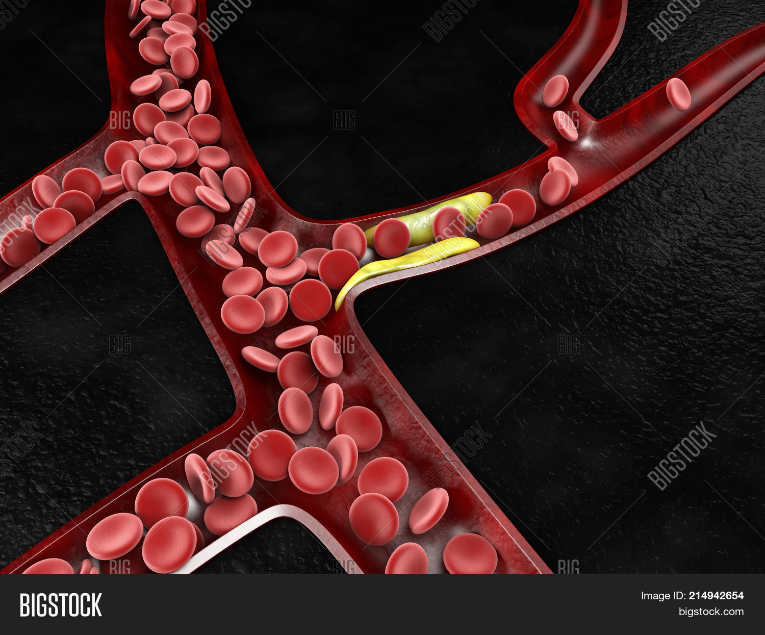 3D Illustration Blood Image & Photo (Free Trial) | Bigstock