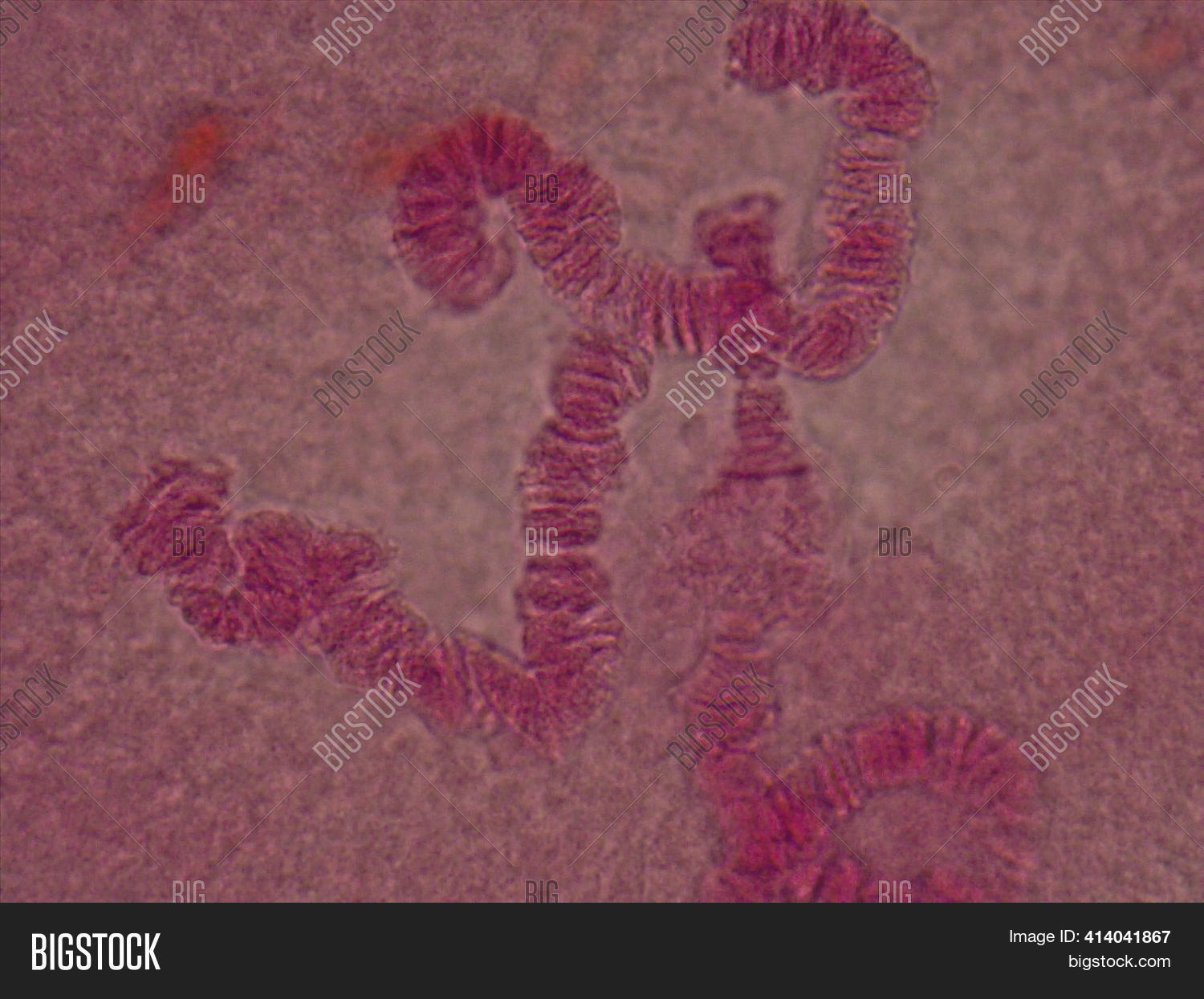 Polytene Chromosome Image & Photo (Free Trial) | Bigstock
