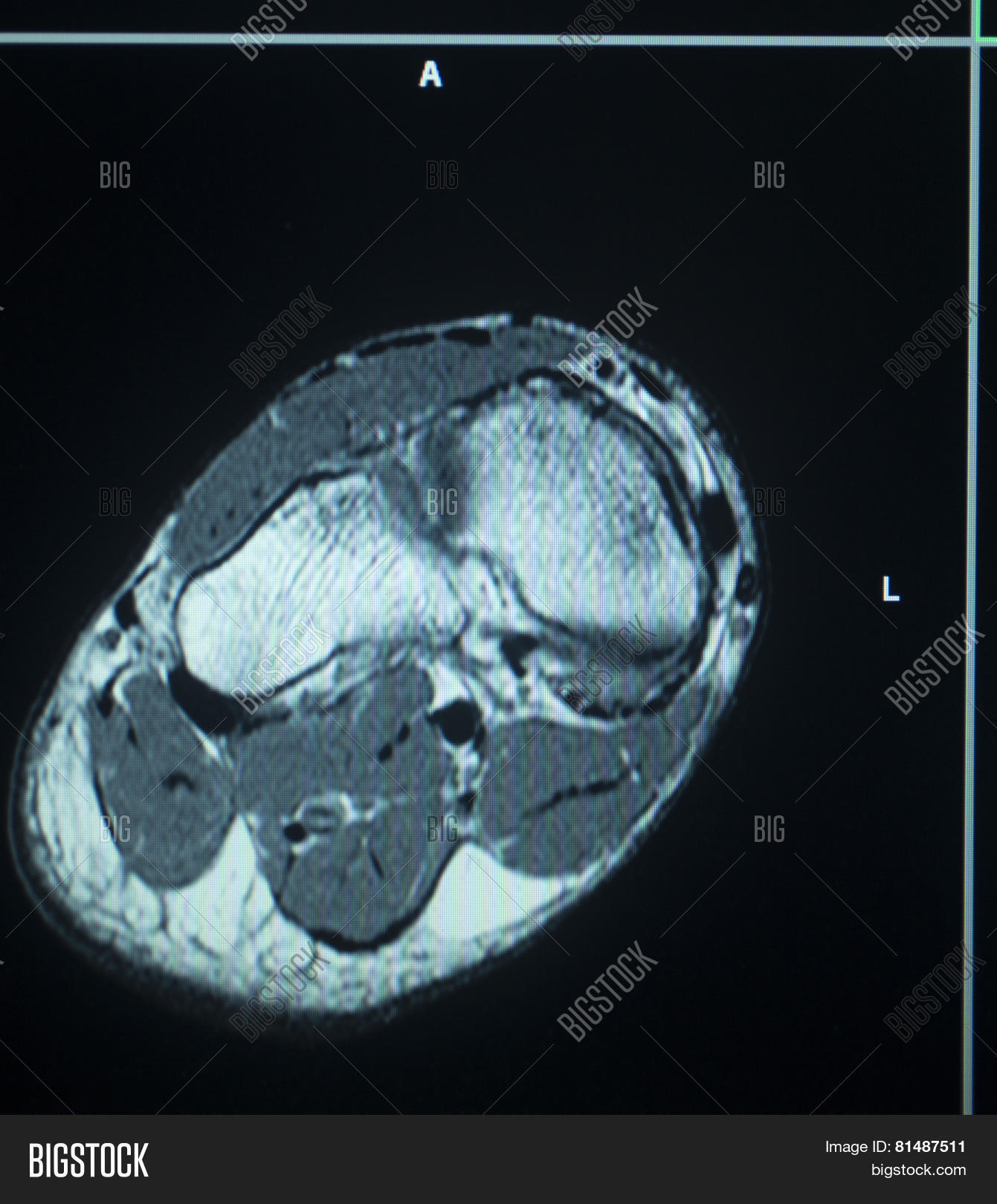 Mri Scan Test Results Image & Photo (Free Trial) | Bigstock