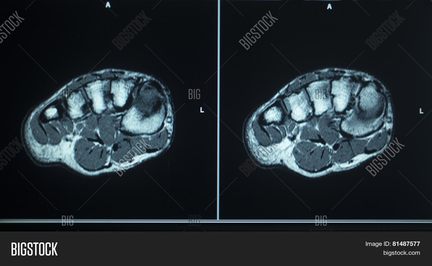 Mri Scan Test Results Image & Photo (Free Trial) | Bigstock