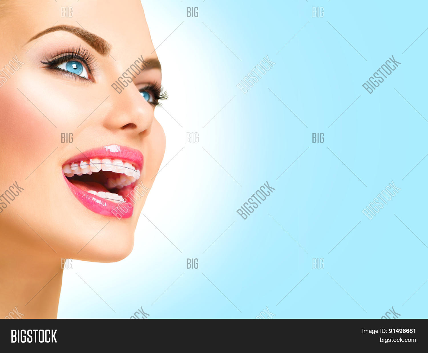 Braces. Beautiful Image & Photo (Free Trial) | Bigstock