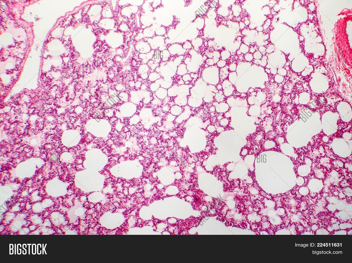 Histology Human Lung Image & Photo (Free Trial) | Bigstock