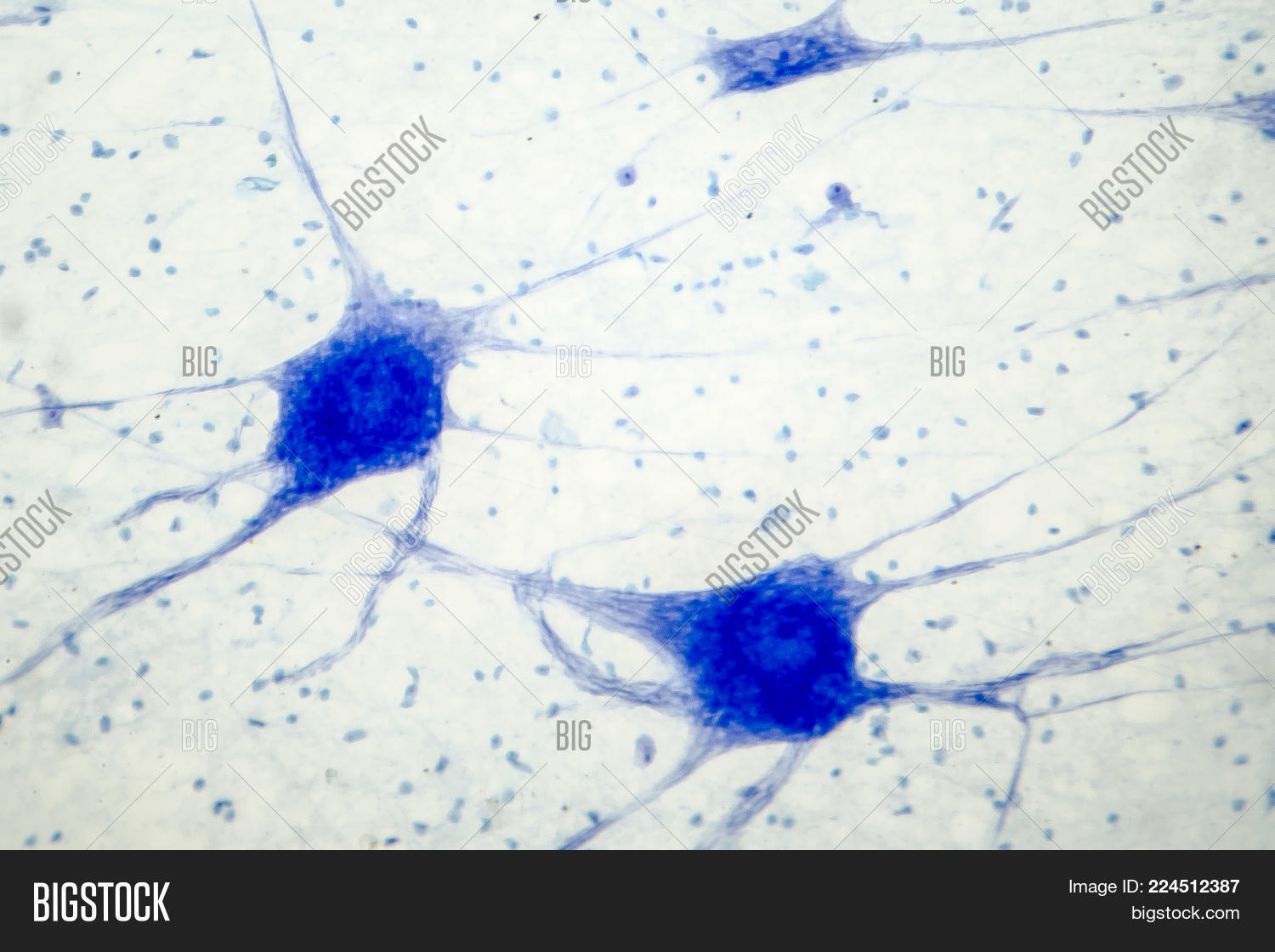 Histology Human Brain Image & Photo (Free Trial) | Bigstock