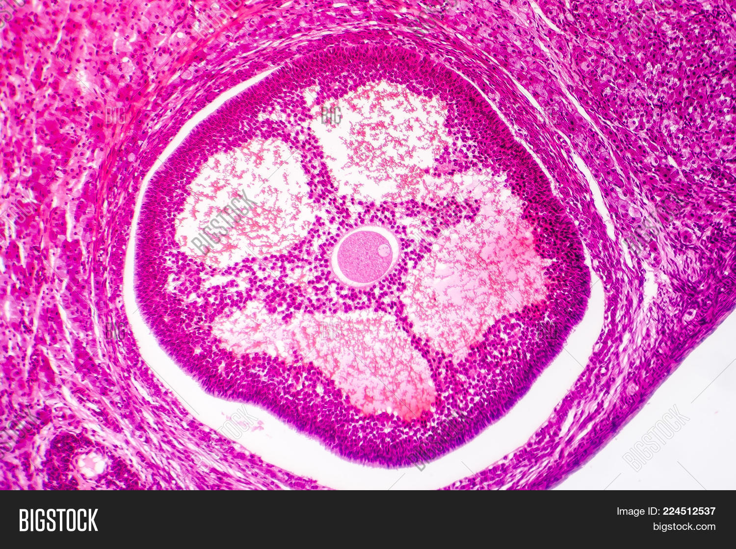 Human Ovary Slide