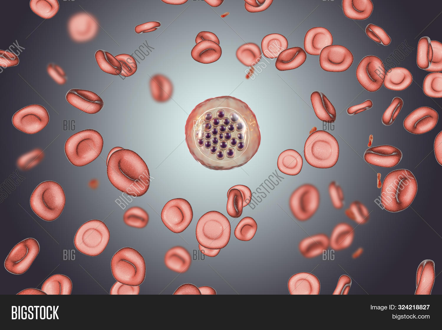 Malaria-infected Red Image & Photo (Free Trial) | Bigstock