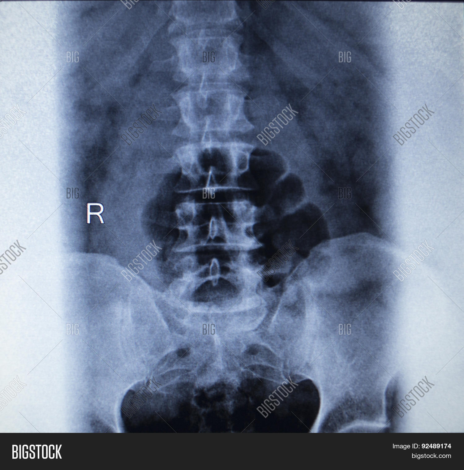 X-ray Orthopedics Image & Photo (Free Trial) | Bigstock