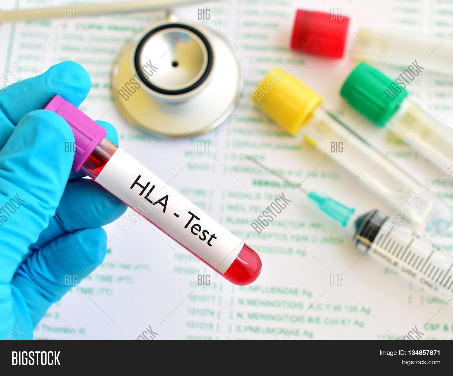 Blood Sample HLA ( Image & Photo (Free Trial) | Bigstock