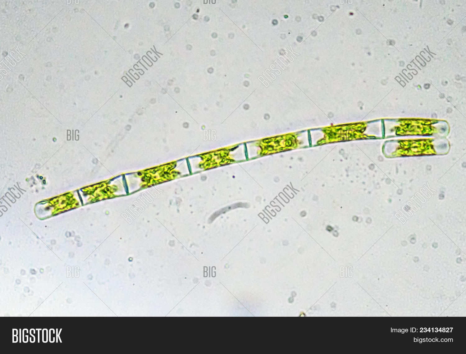 Algae Under Microscope Image & Photo (Free Trial) | Bigstock
