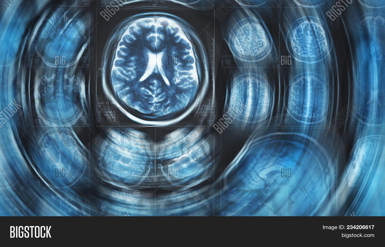 Mri Brain Scan Image & Photo (Free Trial) | Bigstock