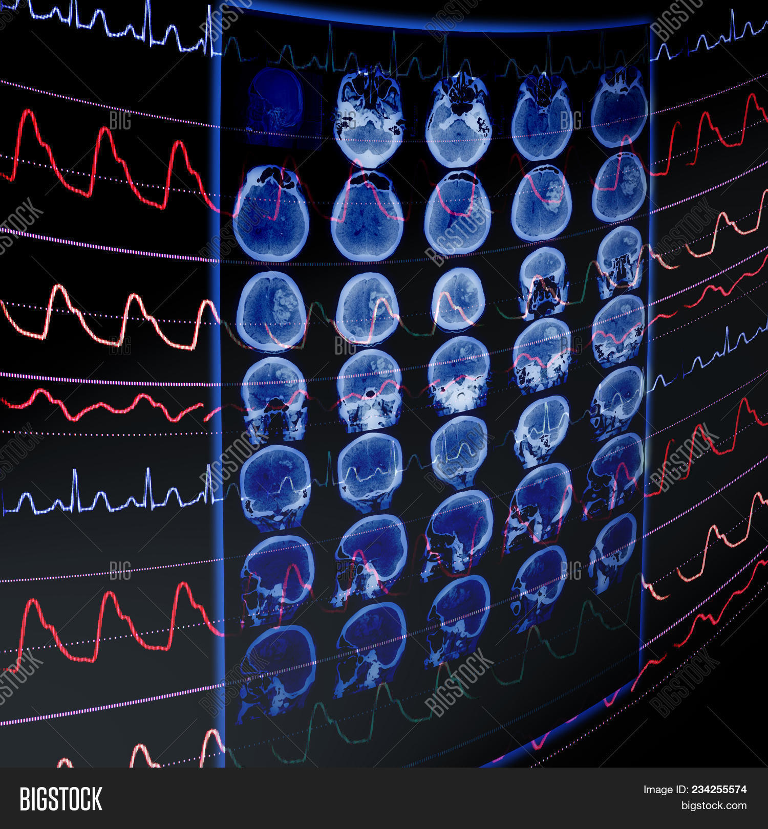 Ct Film Ecg Monitoring Image & Photo (Free Trial) | Bigstock