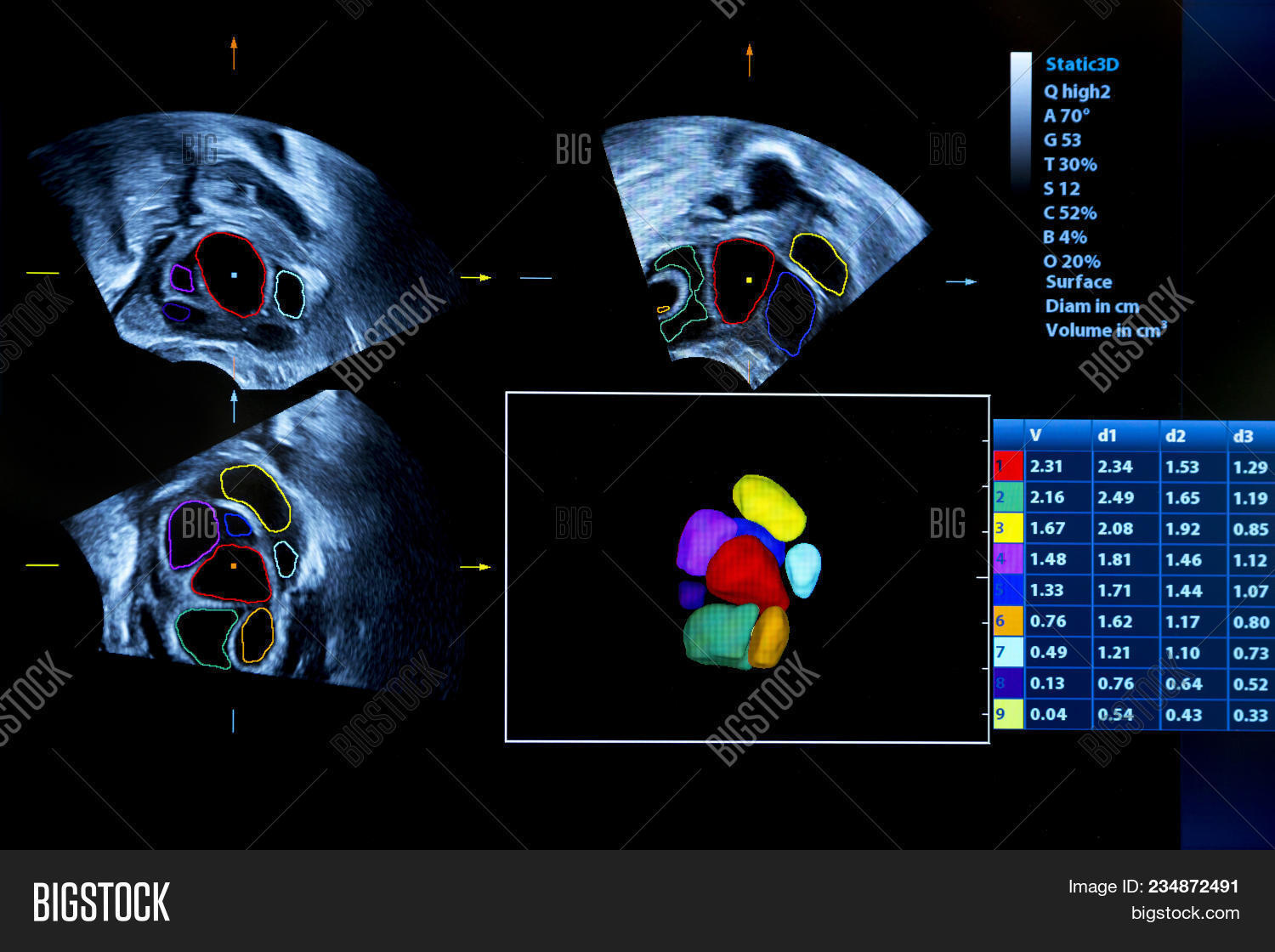 Colourful Image Image & Photo (Free Trial) | Bigstock