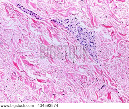 Eccrine Sweat Gland Image & Photo (Free Trial) | Bigstock