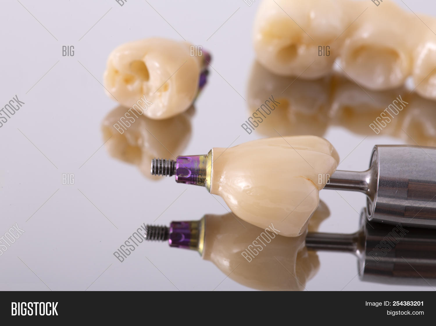 Tooth Human Implant. Image & Photo (Free Trial) | Bigstock
