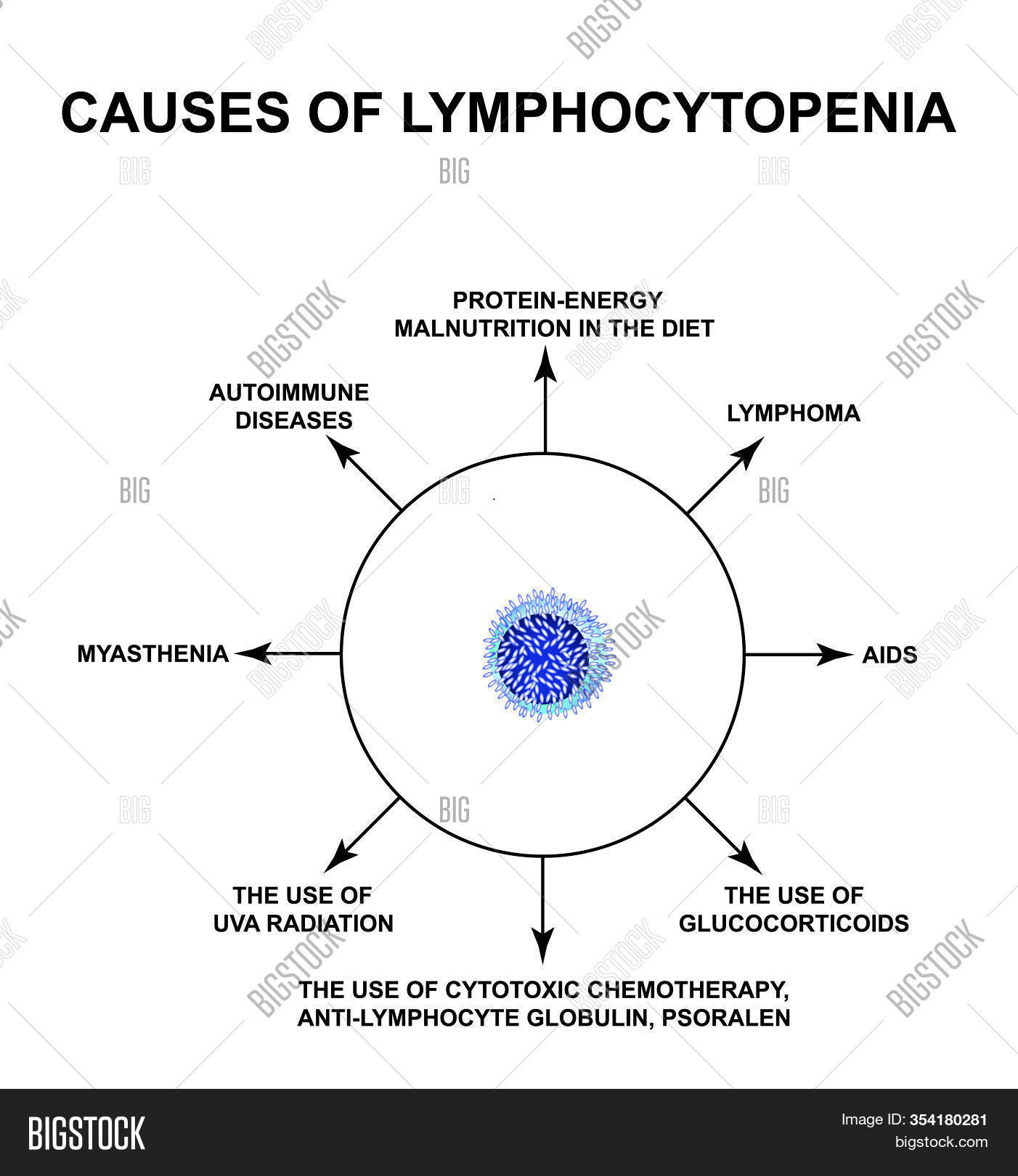 Causes Lymphocytopenia Image & Photo (Free Trial) | Bigstock