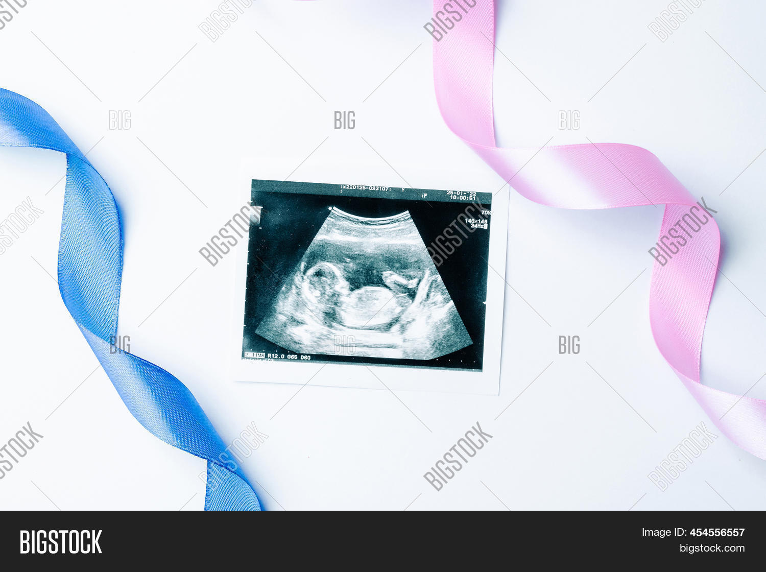 Ultrasound Picture Image And Photo Free Trial Bigstock