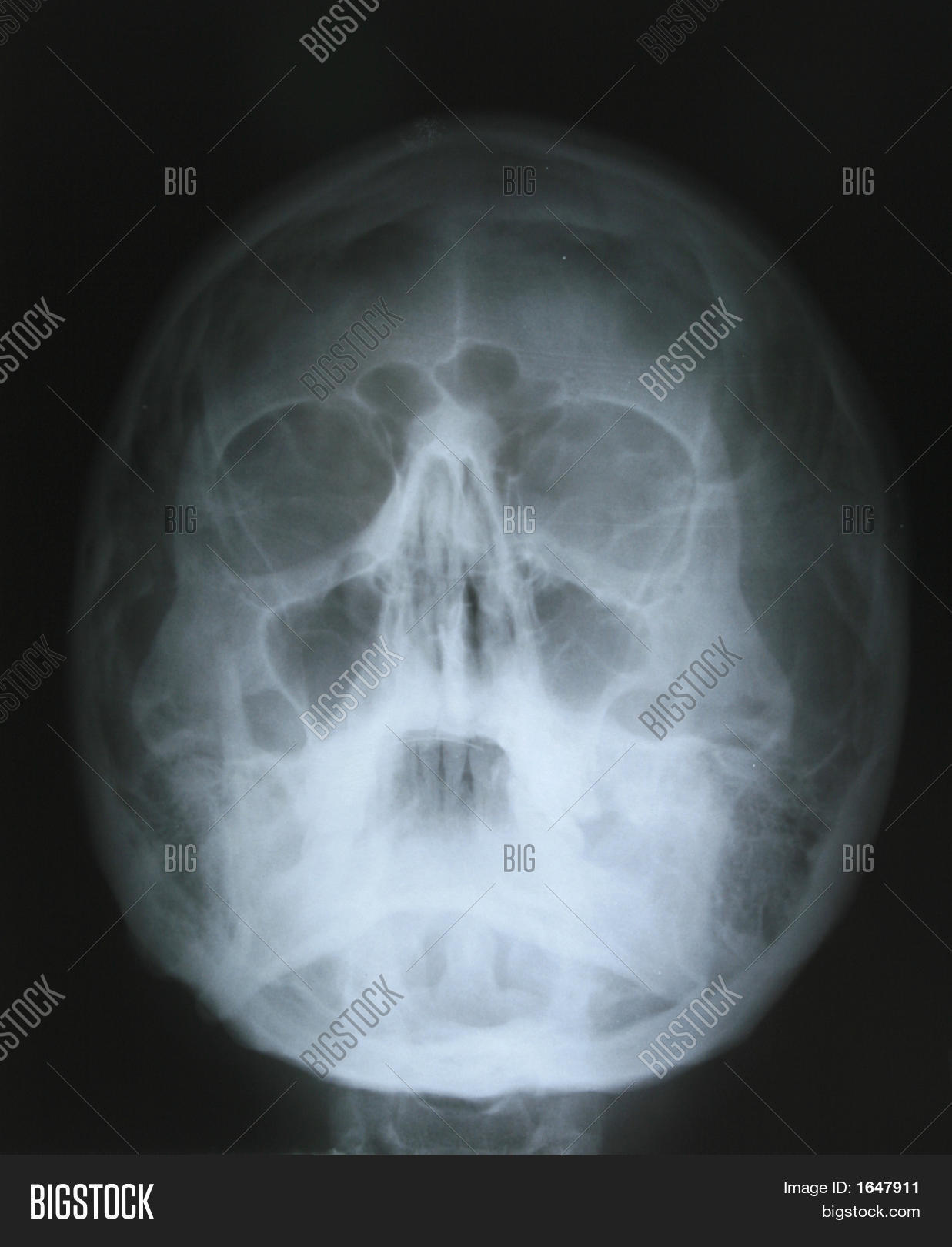 Skull Waters View Image & Photo (Free Trial) | Bigstock