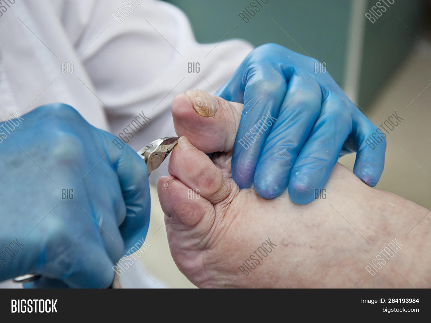 Podiatry. Diabetic Image & Photo (Free Trial) | Bigstock