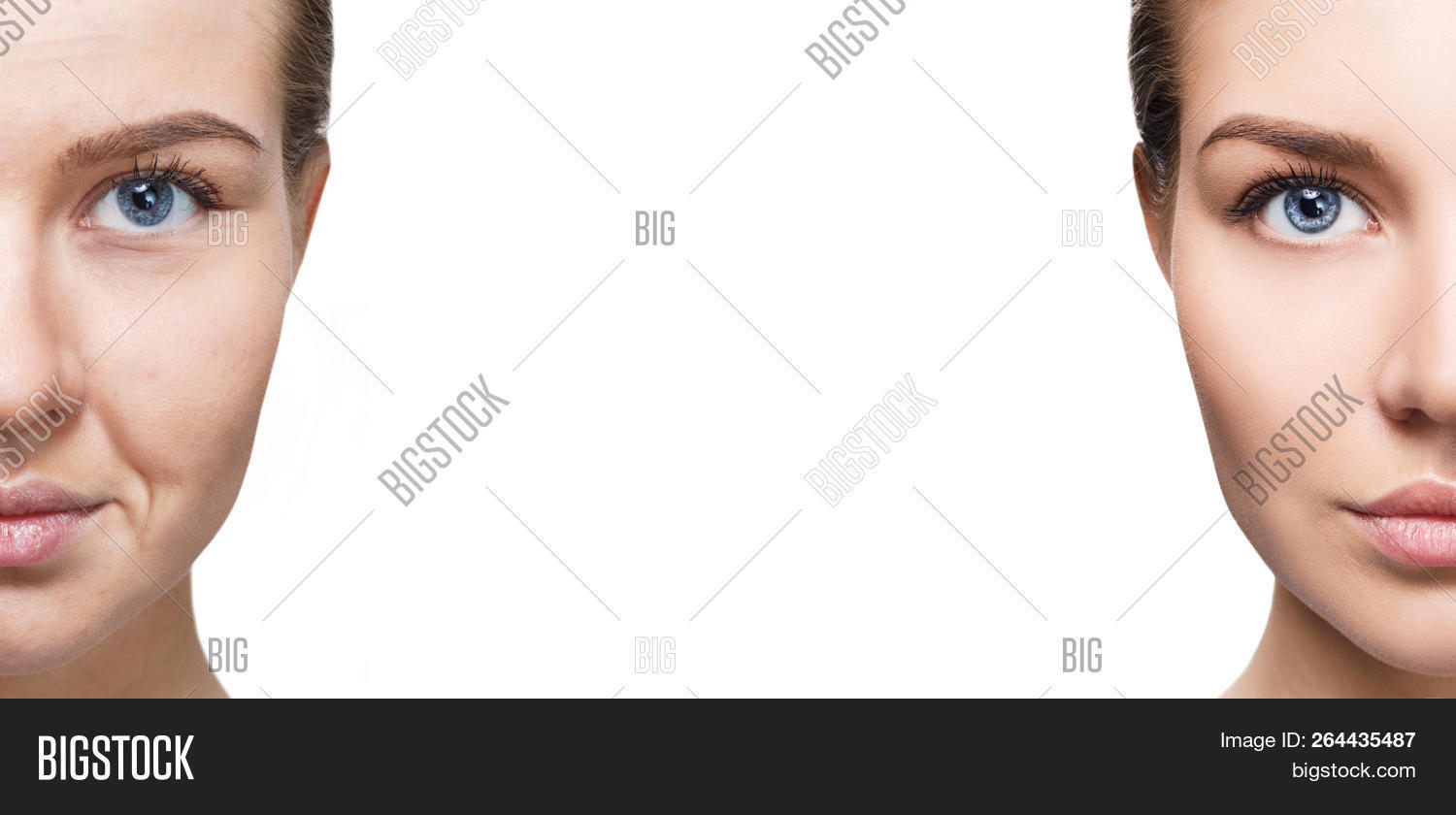Woman Face Before Image & Photo (Free Trial) | Bigstock