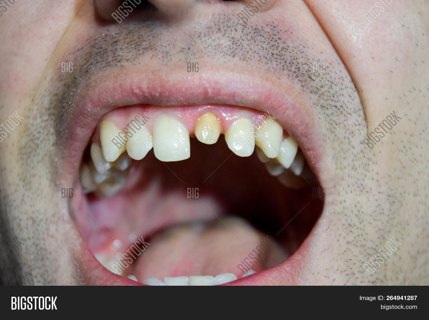 Process Replacing Image & Photo (Free Trial) | Bigstock