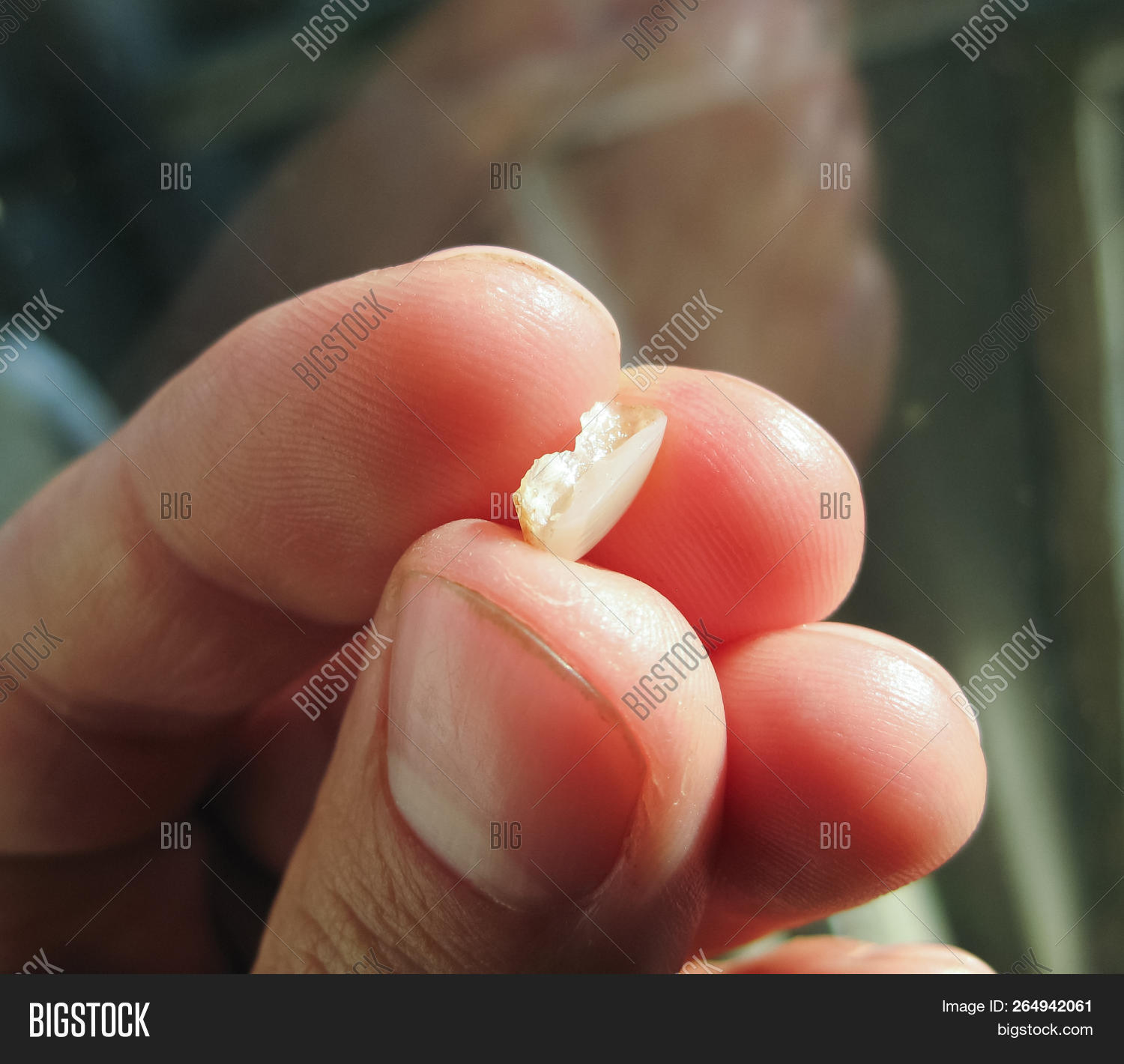 Fallen Off Old Filling Image & Photo (Free Trial) | Bigstock