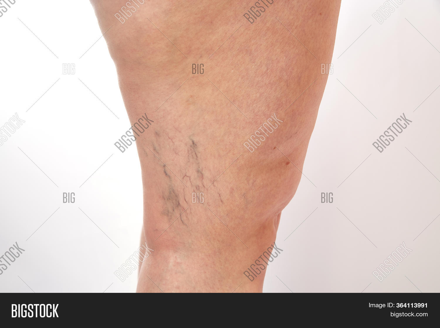 Legs 40-year-old Woman Image & Photo (Free Trial) | Bigstock