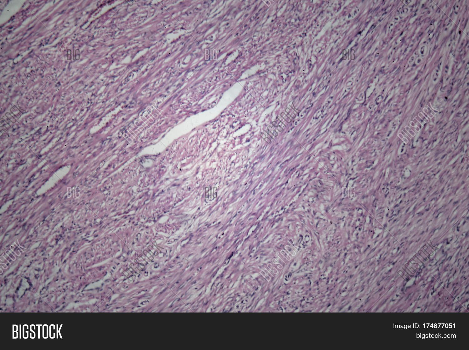 Cells Human Uterus Image & Photo (Free Trial) | Bigstock