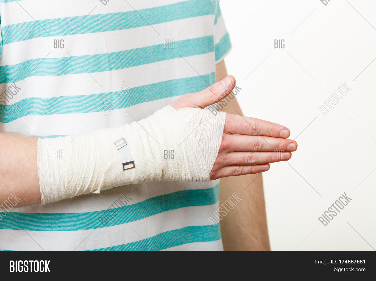 Fractures Dislocations Image & Photo (Free Trial) | Bigstock