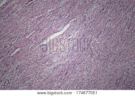 Cells Human Uterus Image & Photo (Free Trial) | Bigstock