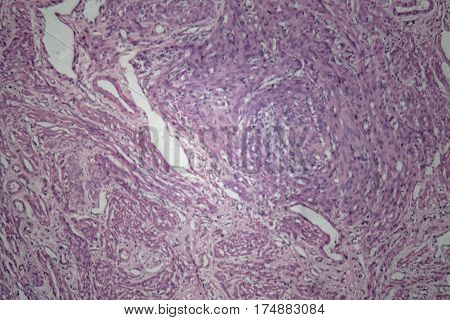 Cells Human Uterus Image & Photo (Free Trial) | Bigstock