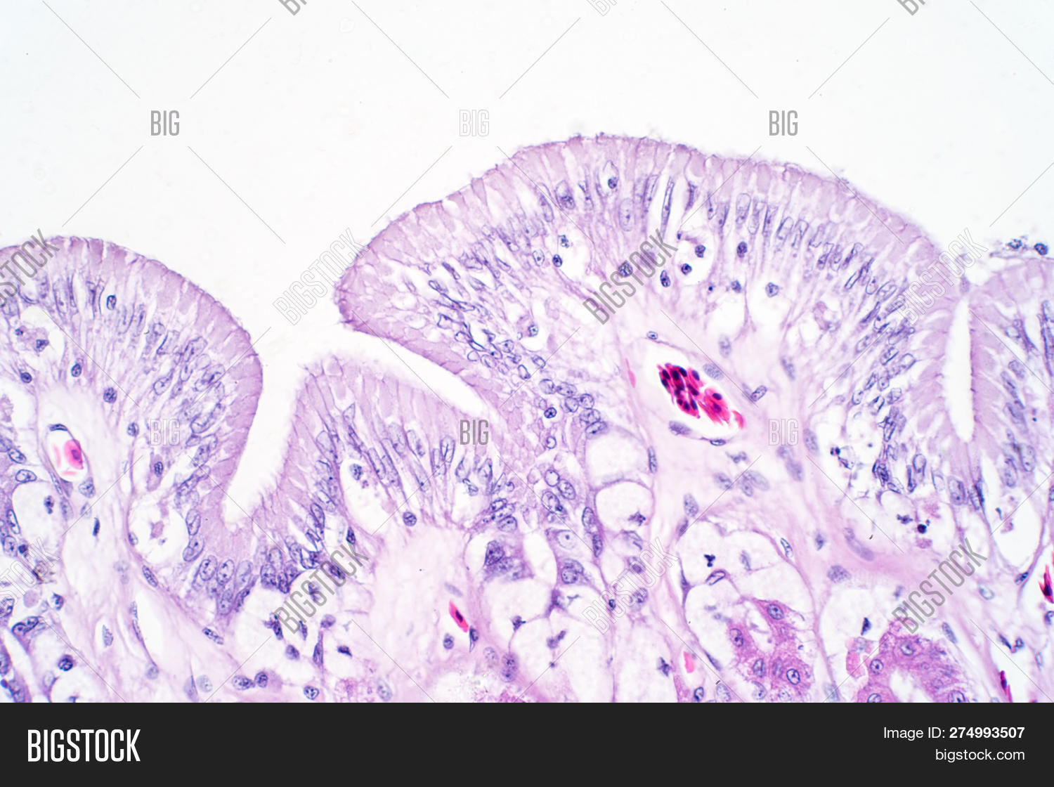 Human Large Intestine Image & Photo (Free Trial) | Bigstock