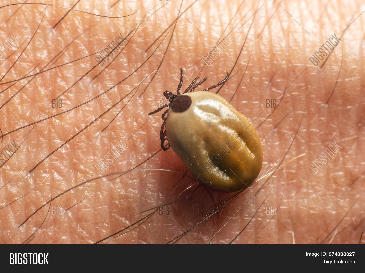 Tick Drunk On Blood Image & Photo (Free Trial) | Bigstock