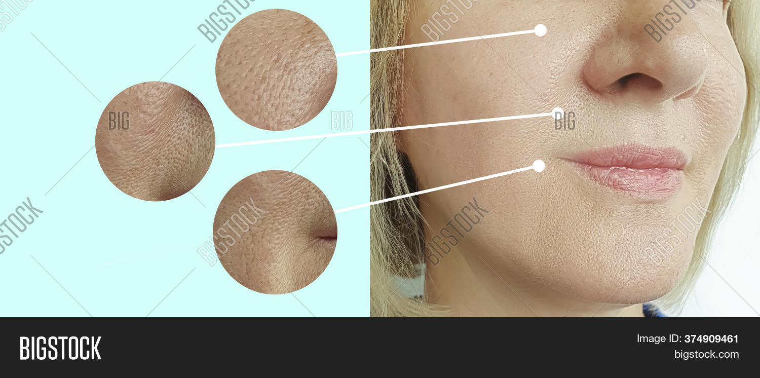 Woman Face Wrinkles Image & Photo (Free Trial) | Bigstock