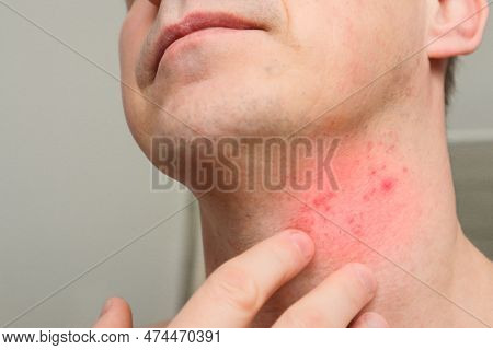 Man Shows Cut Image & Photo (Free Trial) | Bigstock