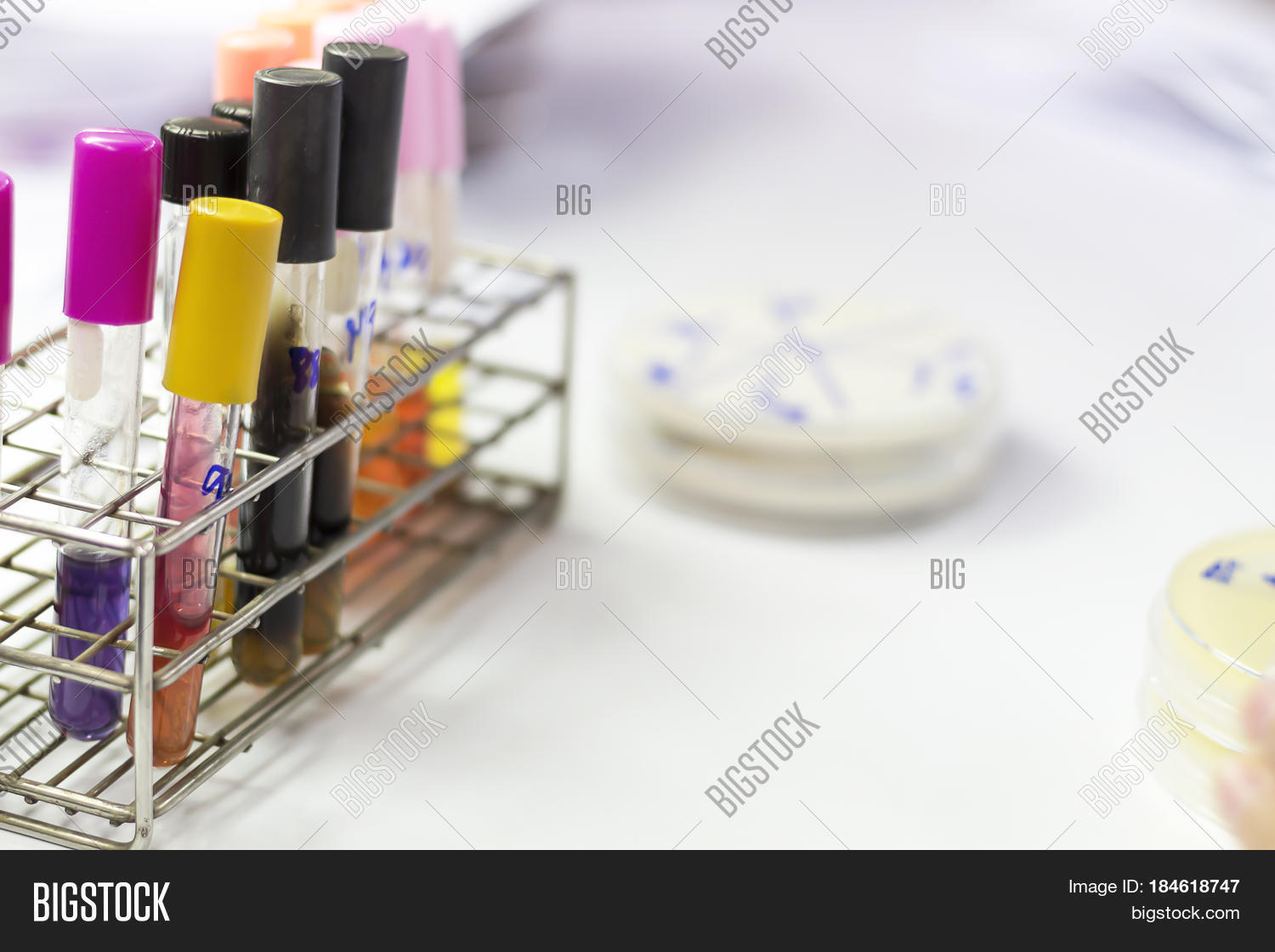 Woven Tube Inserts Image & Photo (Free Trial) | Bigstock