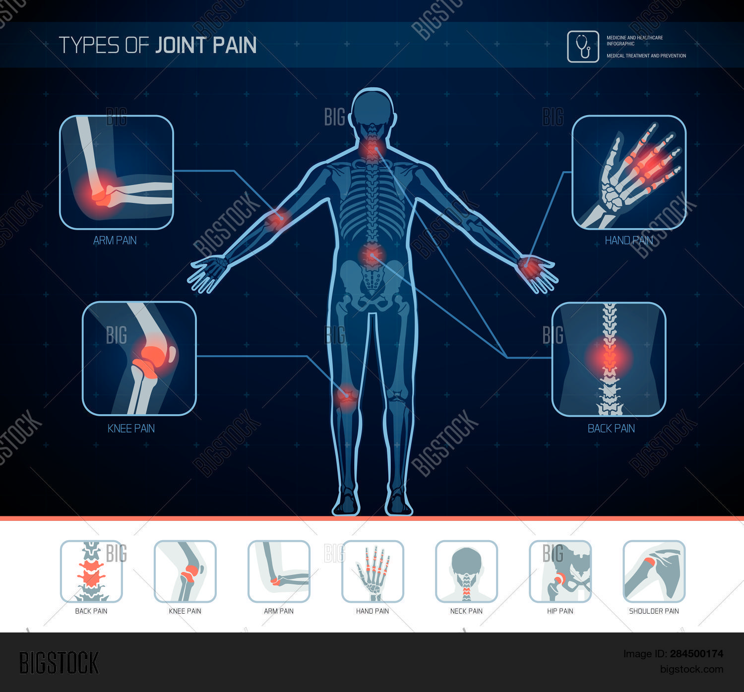 Types Joint Pain Vector & Photo (Free Trial) | Bigstock