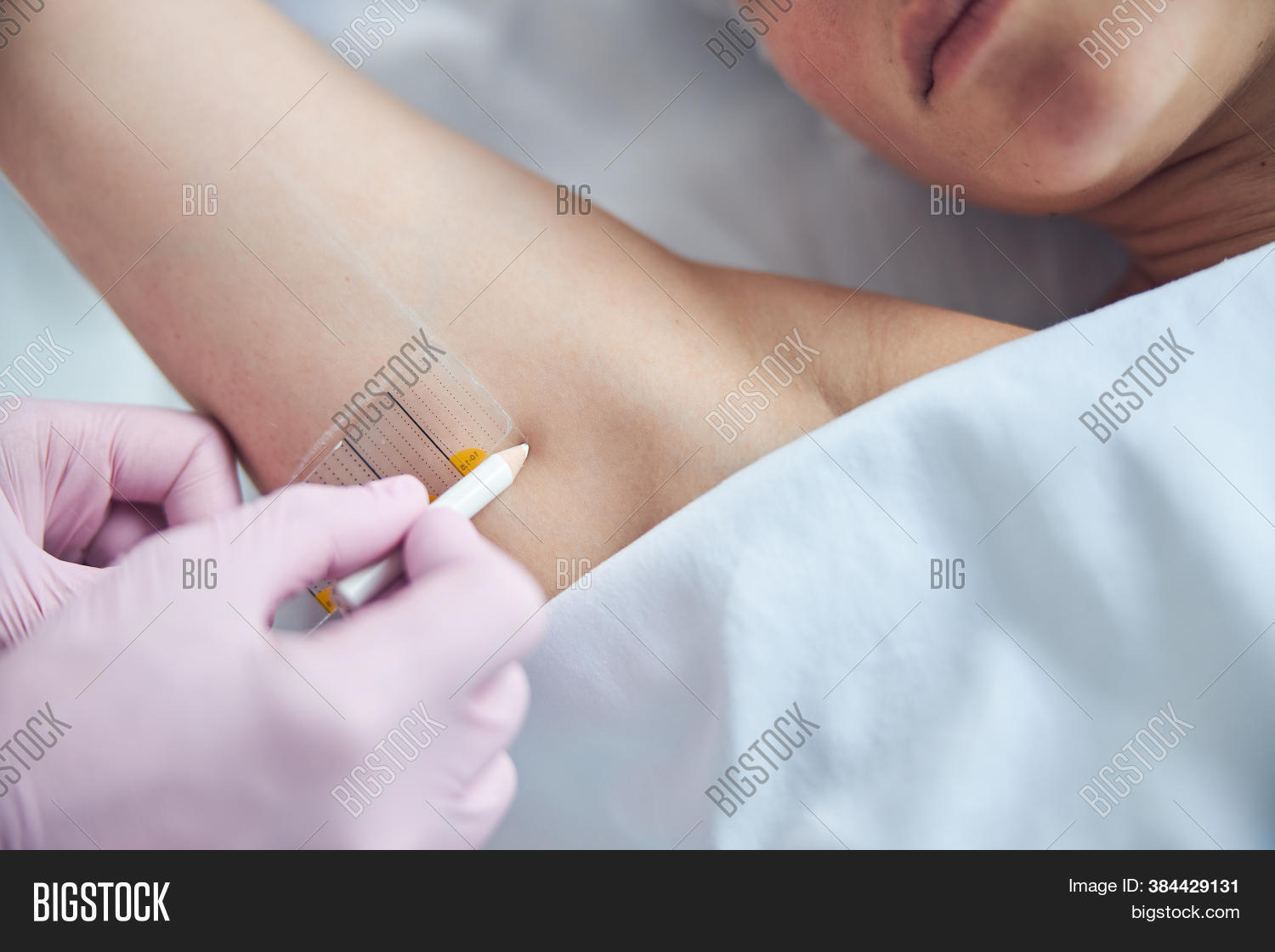 Skin Measurement Stage Image & Photo (Free Trial) | Bigstock