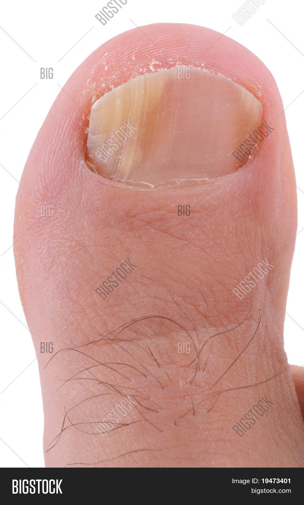 Close Image Right Foot Image & Photo (Free Trial) | Bigstock