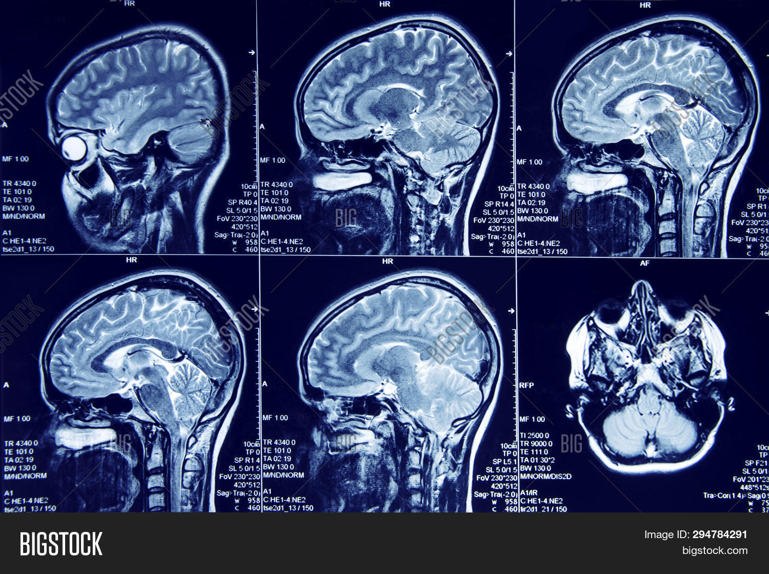 Mri Image Brain On Image & Photo (Free Trial) | Bigstock