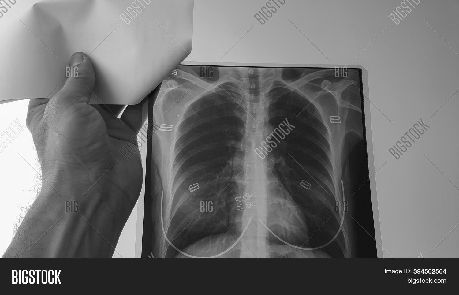 Doctor Checks X-ray Image & Photo (Free Trial) | Bigstock
