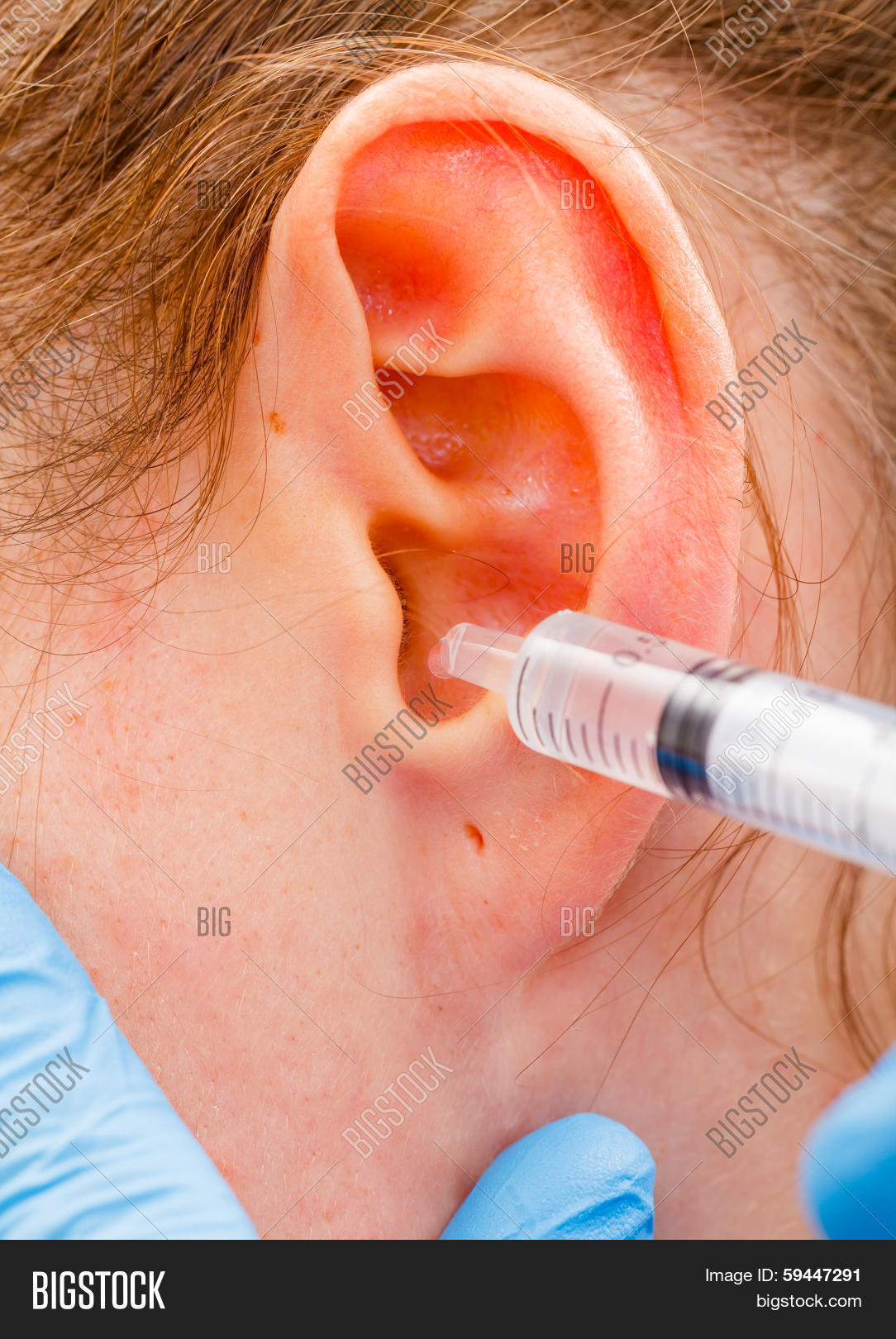 Ear Wash Image & Photo (Free Trial) | Bigstock