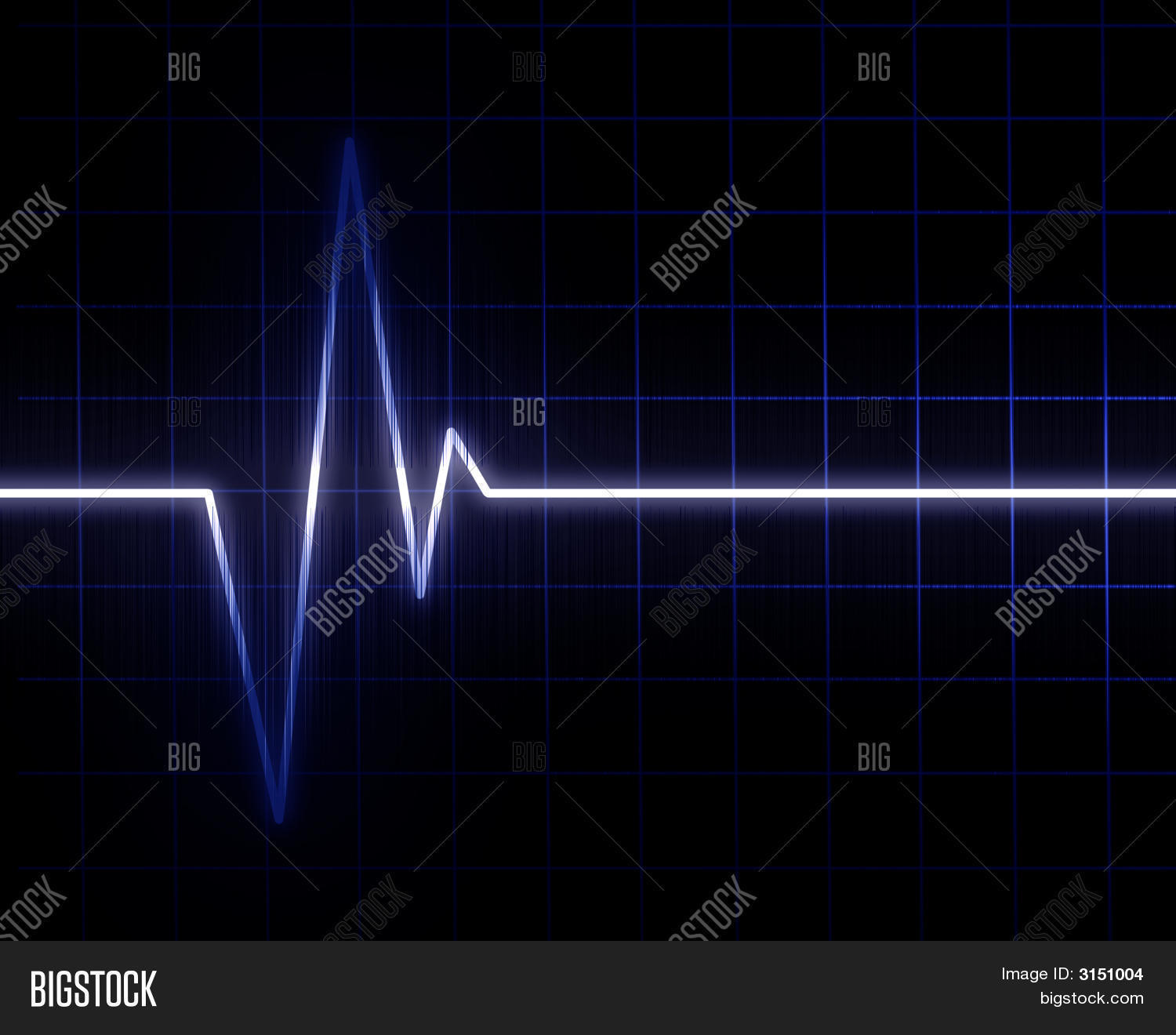 Heart Beat Image & Photo (Free Trial) | Bigstock