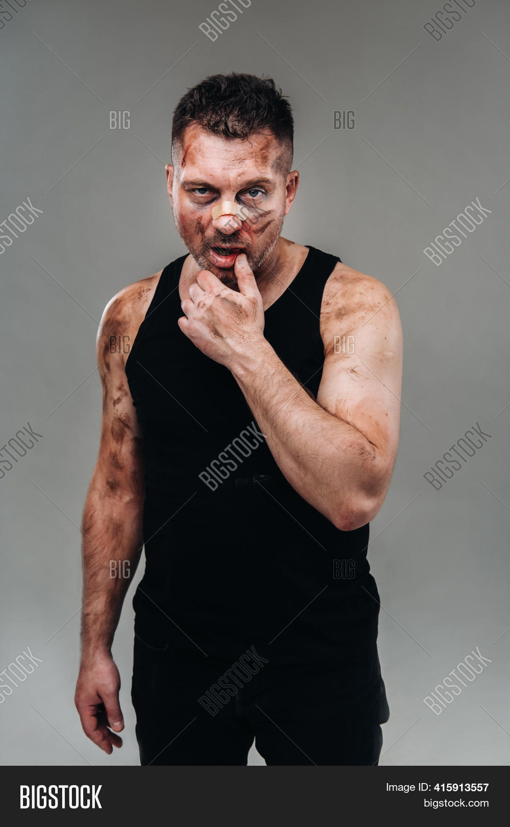 Battered Man Black T Image & Photo (Free Trial) | Bigstock