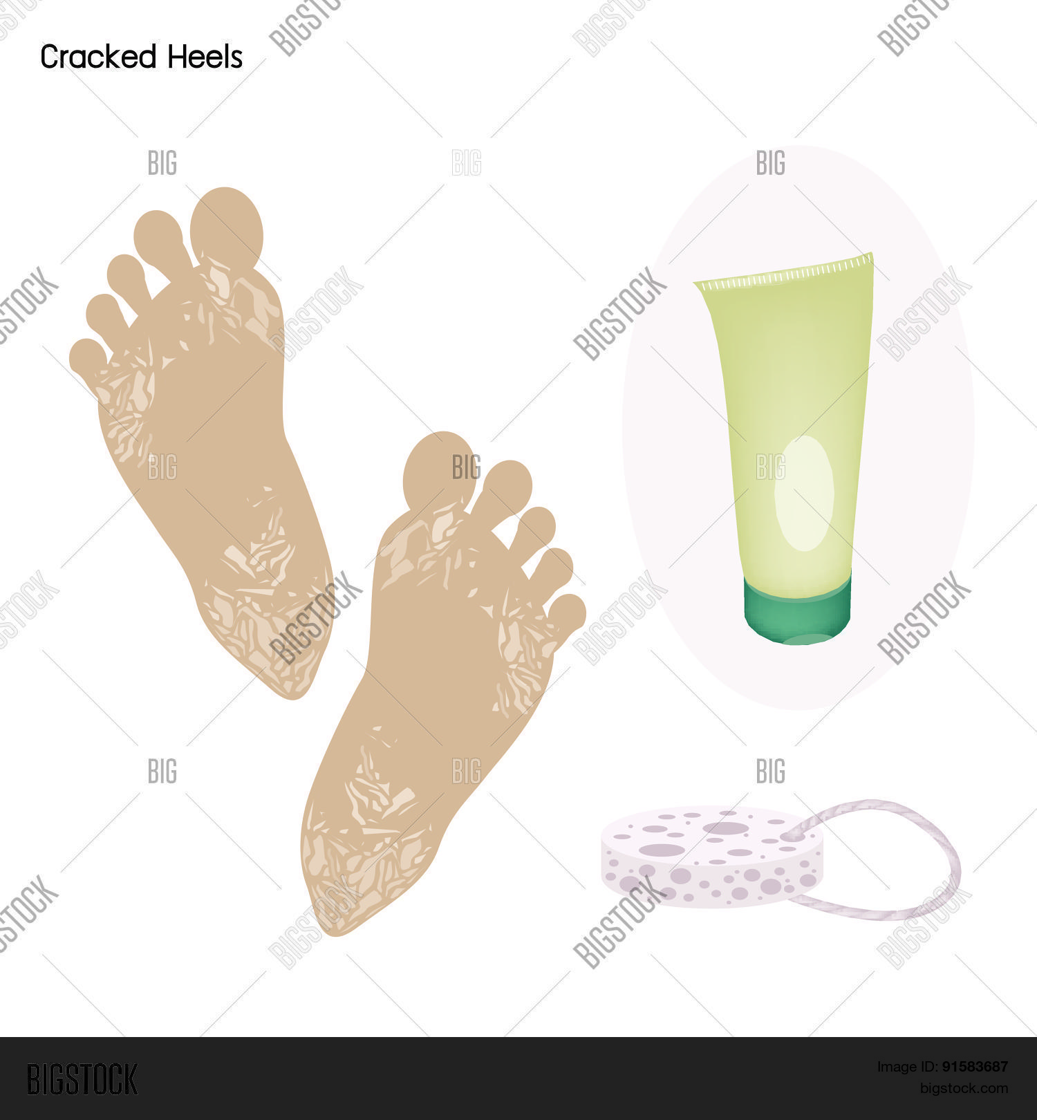 Cracked Heels Vector & Photo (Free Trial) | Bigstock