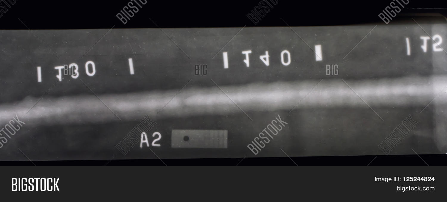 X-ray Site Weld Large Image & Photo (Free Trial) | Bigstock