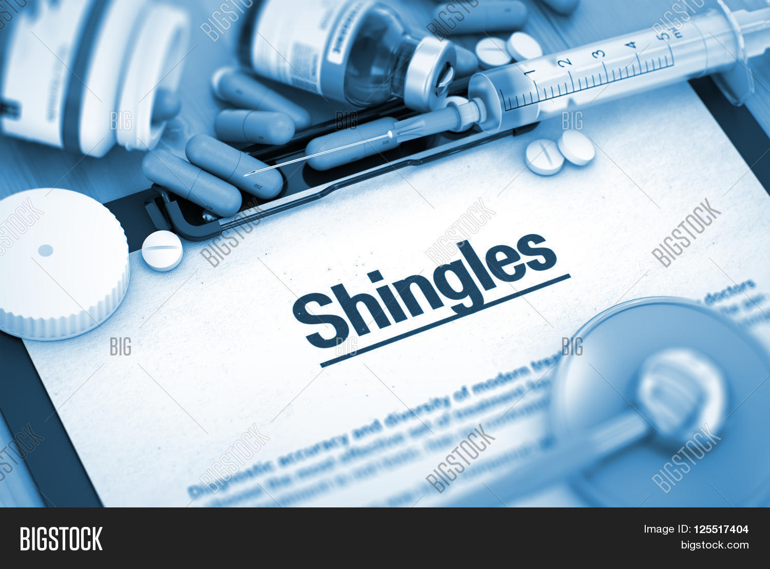 Shingles, Medical Image & Photo (Free Trial) | Bigstock