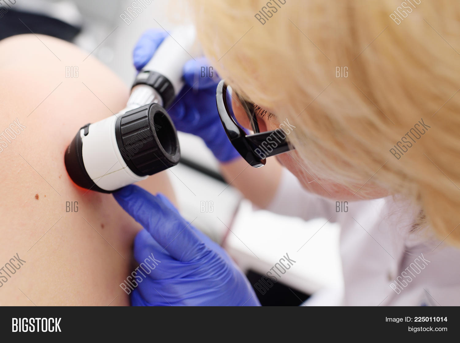 Method Dermatoscopy Image & Photo (Free Trial) | Bigstock