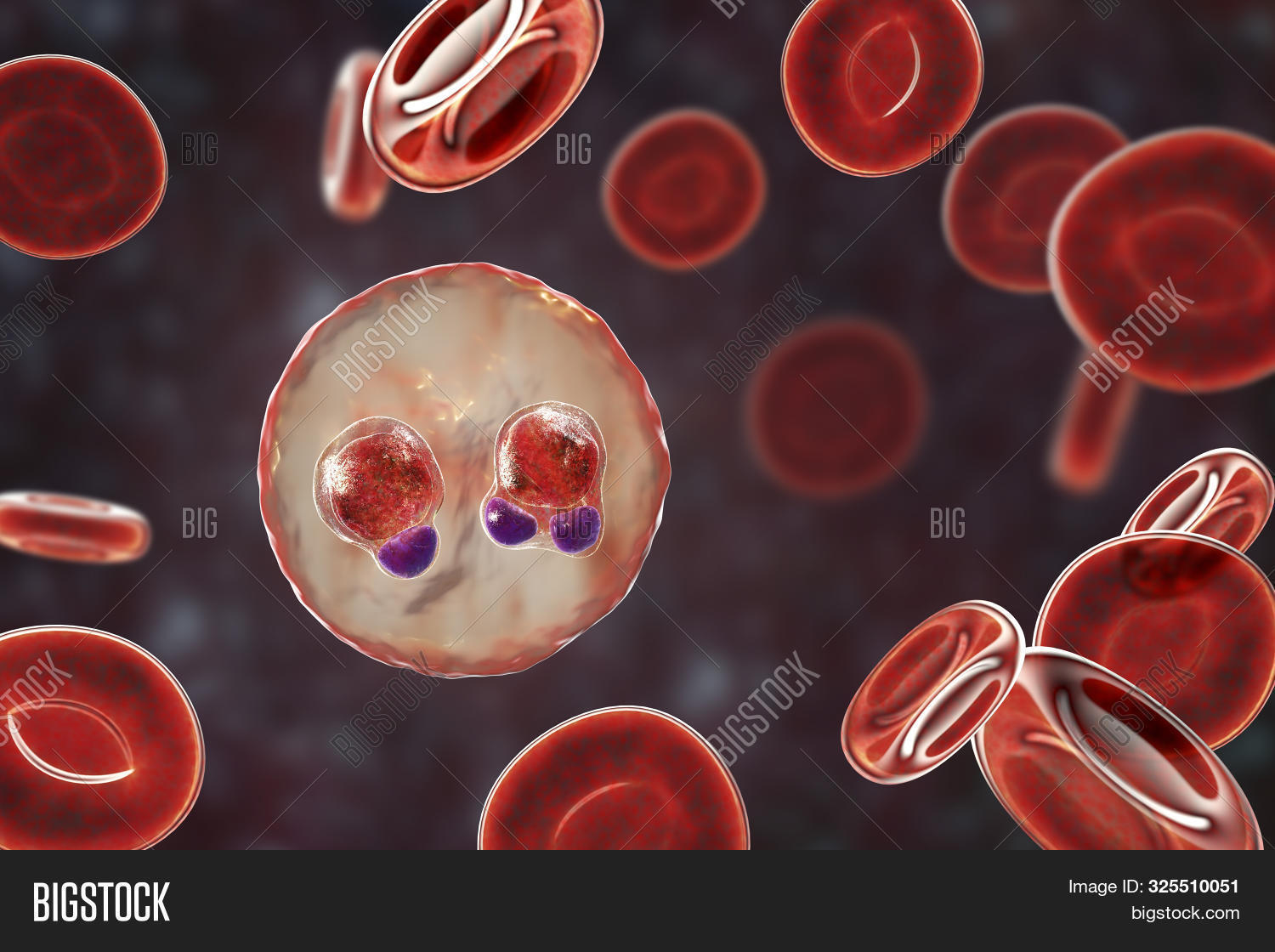 Malaria-infected Red Image & Photo (Free Trial) | Bigstock