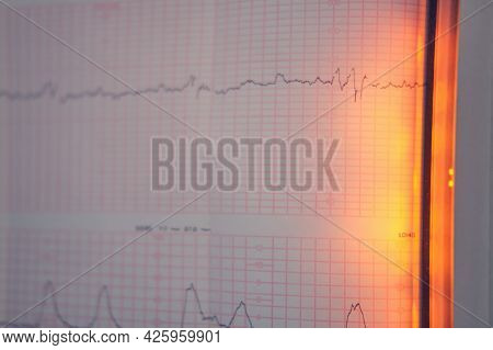 Ctg Device Monitoring Image & Photo (Free Trial) | Bigstock