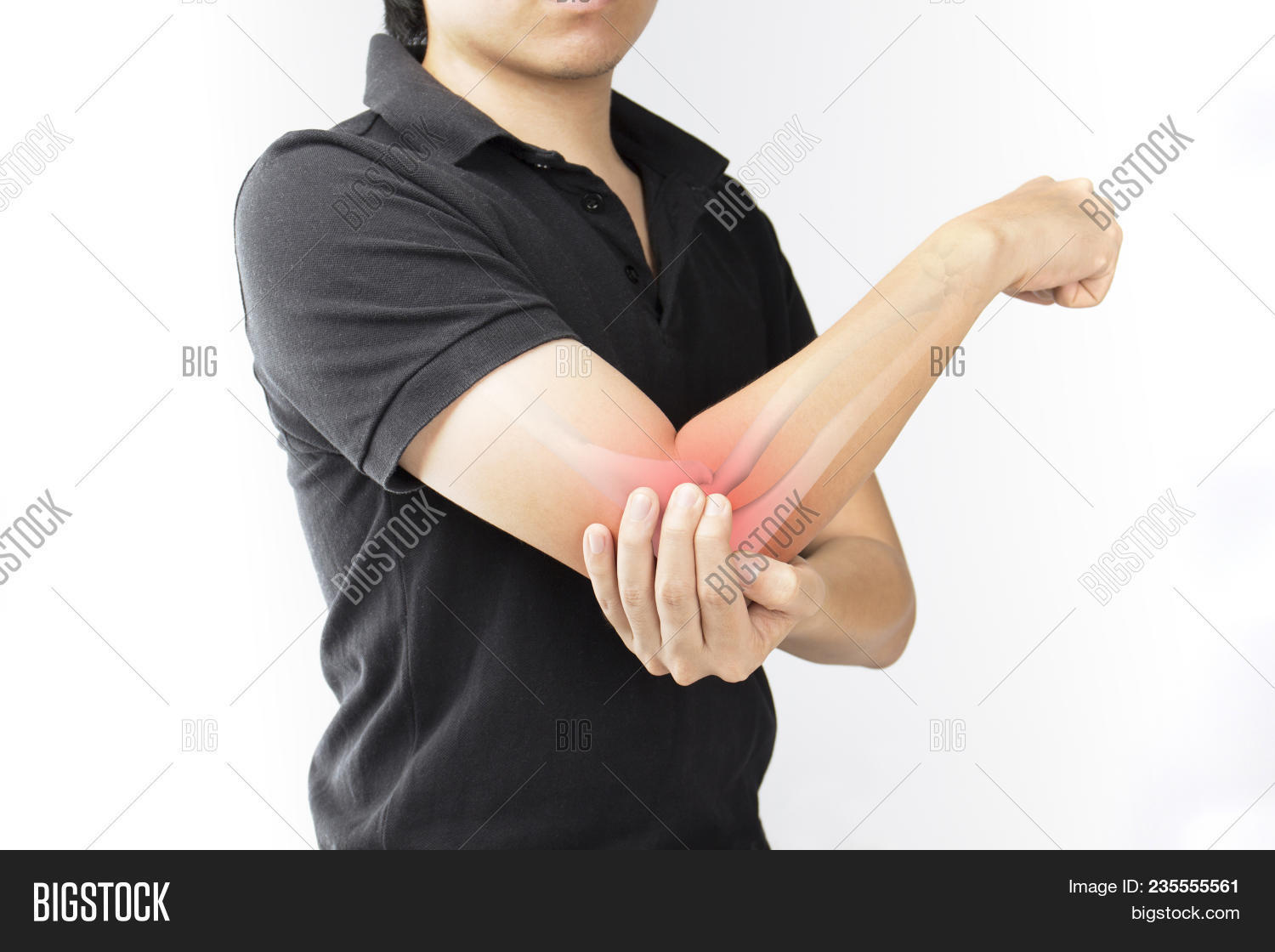 Elbow Bones Injury Image & Photo (Free Trial) | Bigstock