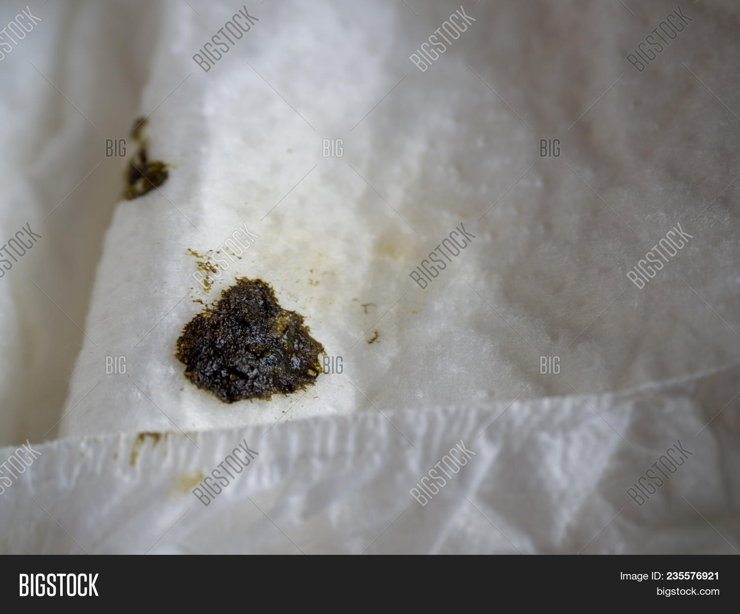 Excrement Newborn Image & Photo (Free Trial) | Bigstock